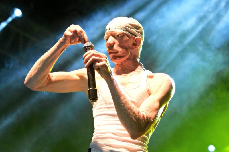 Yellowman Getting Visuals Ready From 'No More War' Album - DancehallMag